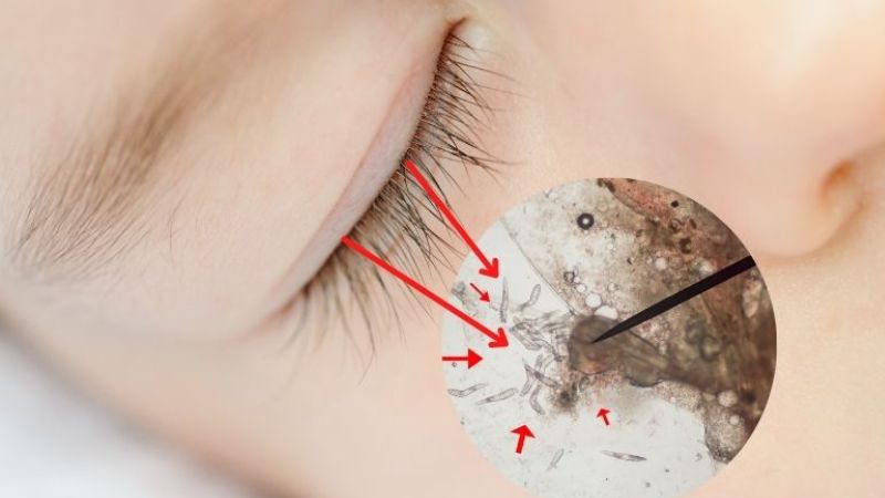 How to spot eyelash mites - The Animalz